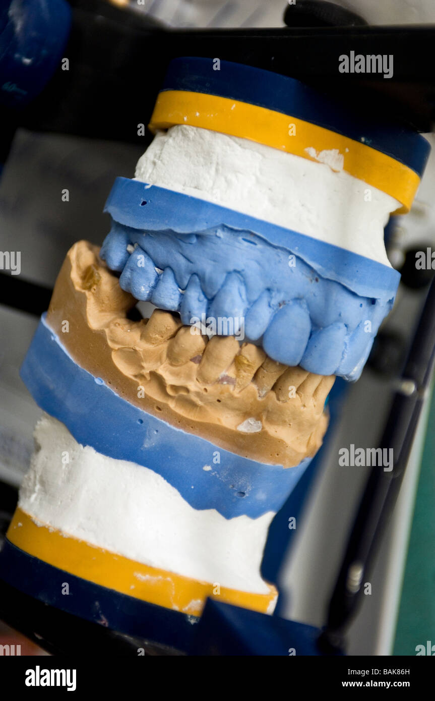 Dental lab making false teeth Stock Photo - Alamy