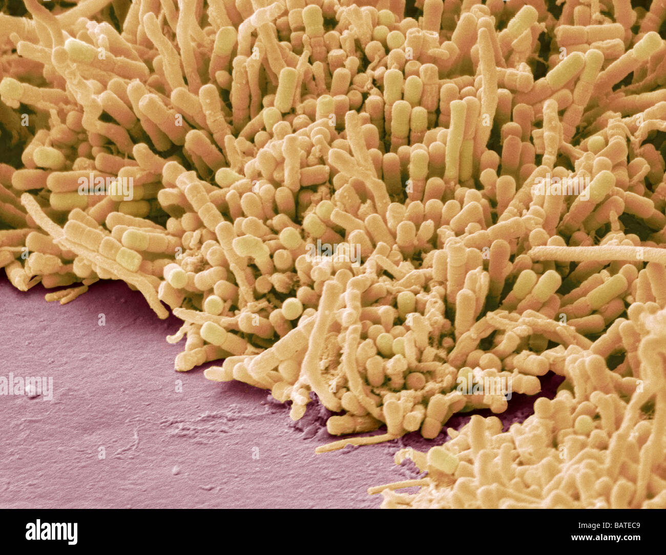 Bacterial Plaque