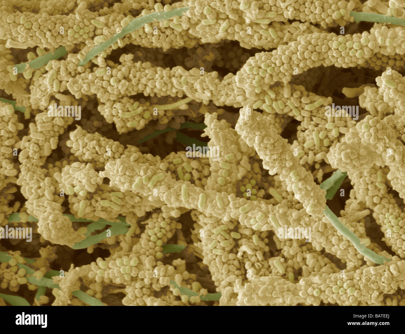 Plaque-forming bacteria, coloured scanningelectron micrograph(SEM ... Plaque-forming bacteria, coloured scanningelectron micrograph(SEM ...