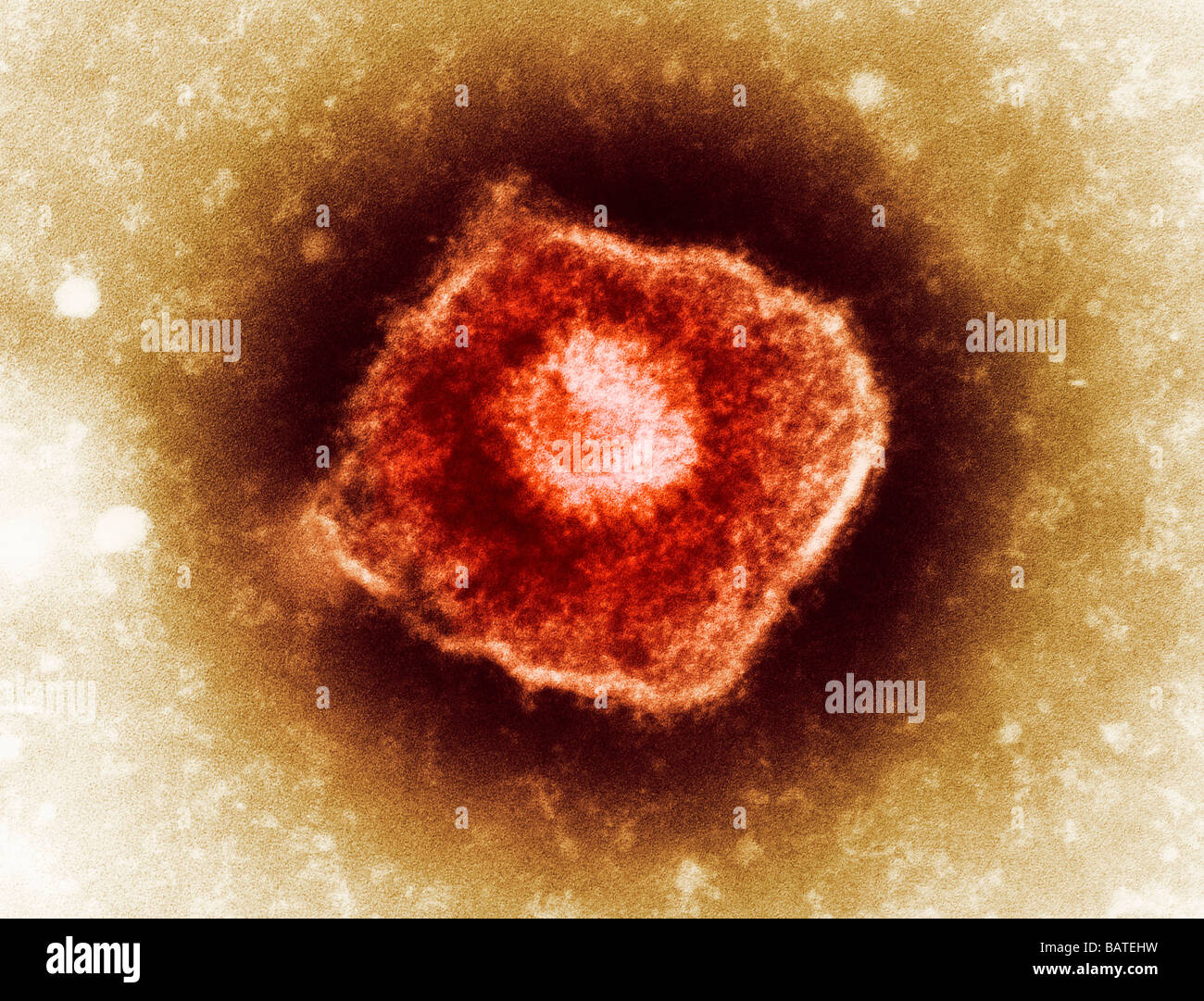 Varicella zoster virus (VZV) particle, coloured transmission electron ...