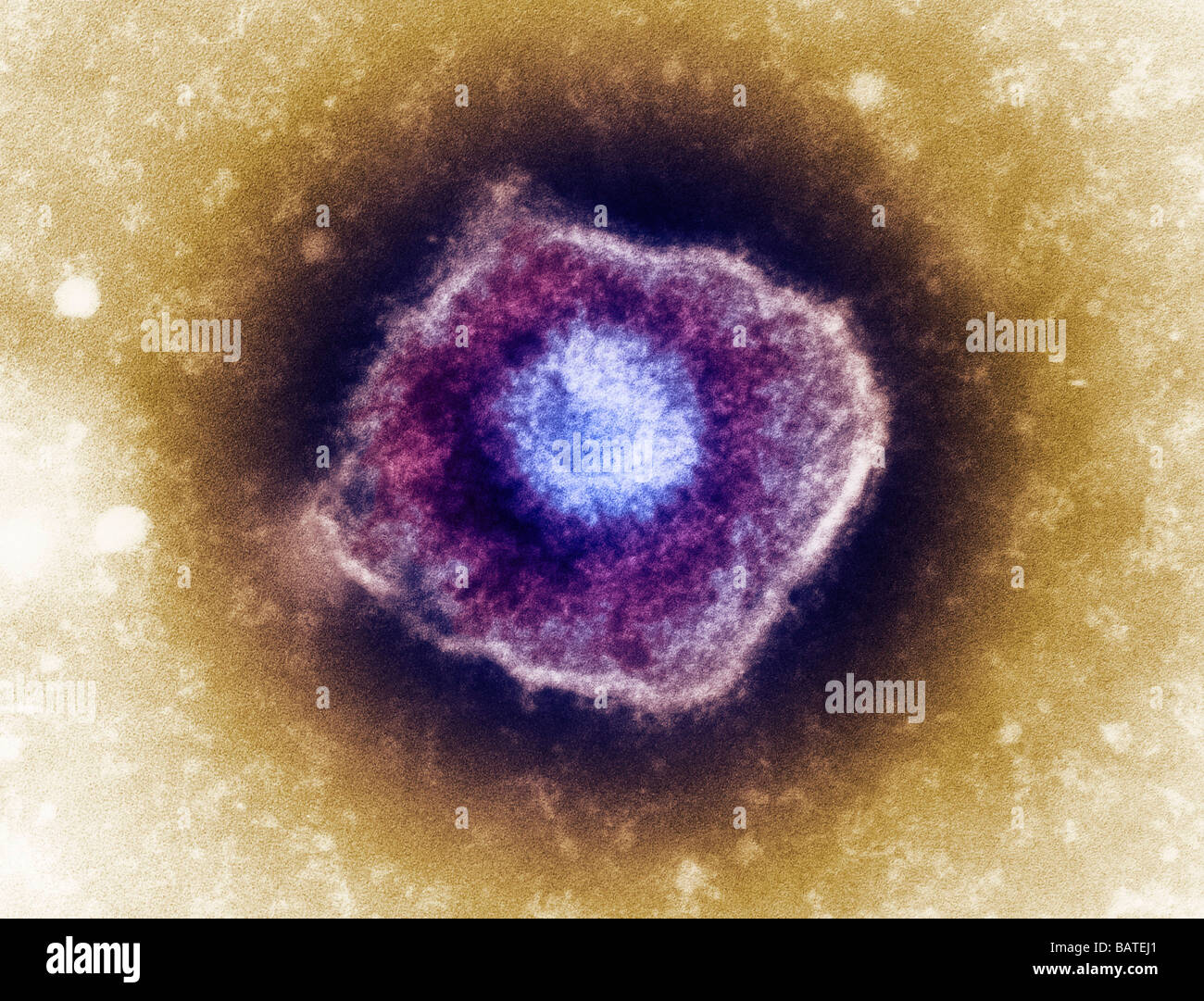 Varicella zoster virus (VZV) particle, coloured transmission electron ...