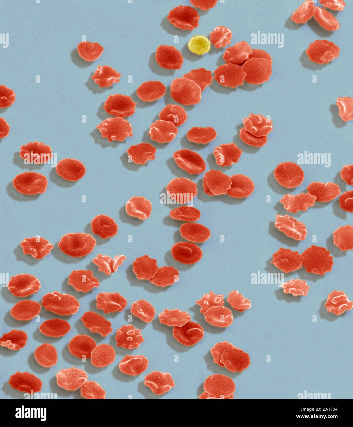 Transmission electron microscopy cells hi-res stock photography and ...