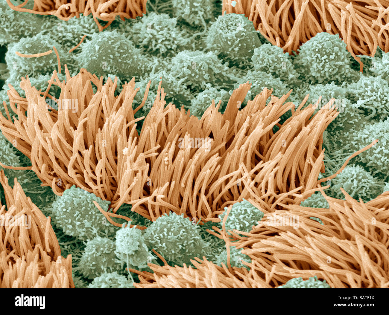 Fallopian tube. Coloured scanning electronmicrograph (SEM) of the ...