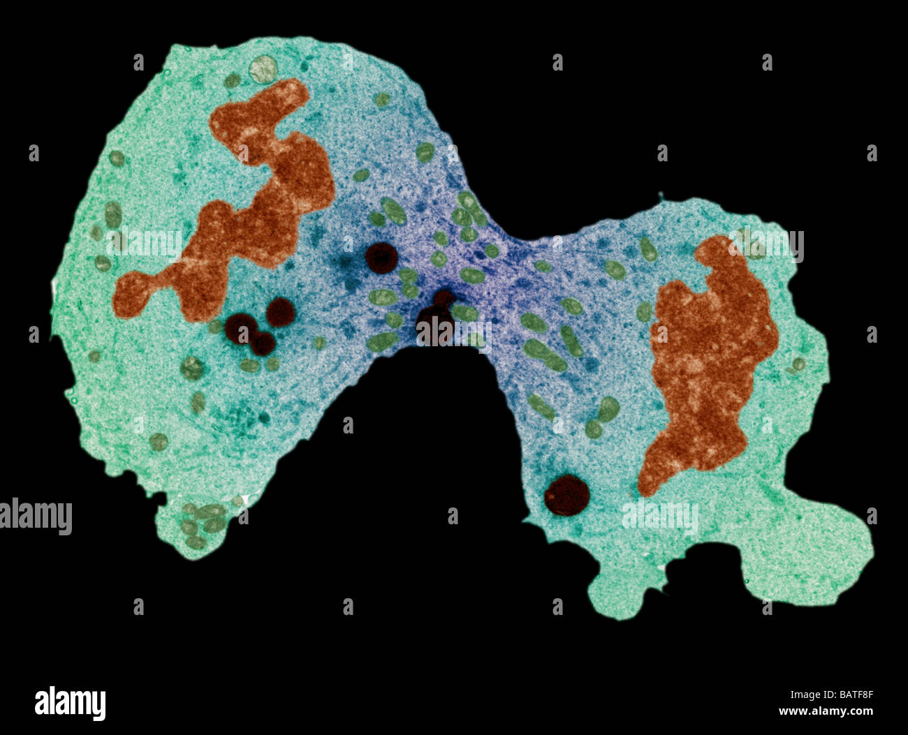 Cancer cell division. Coloured transmissionelectron micrograph (TEM) of ...