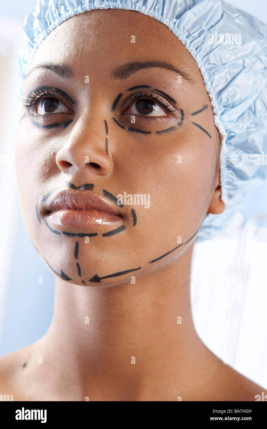 Face lift. Guide lines for surgical incisions on a patient face Stock ...