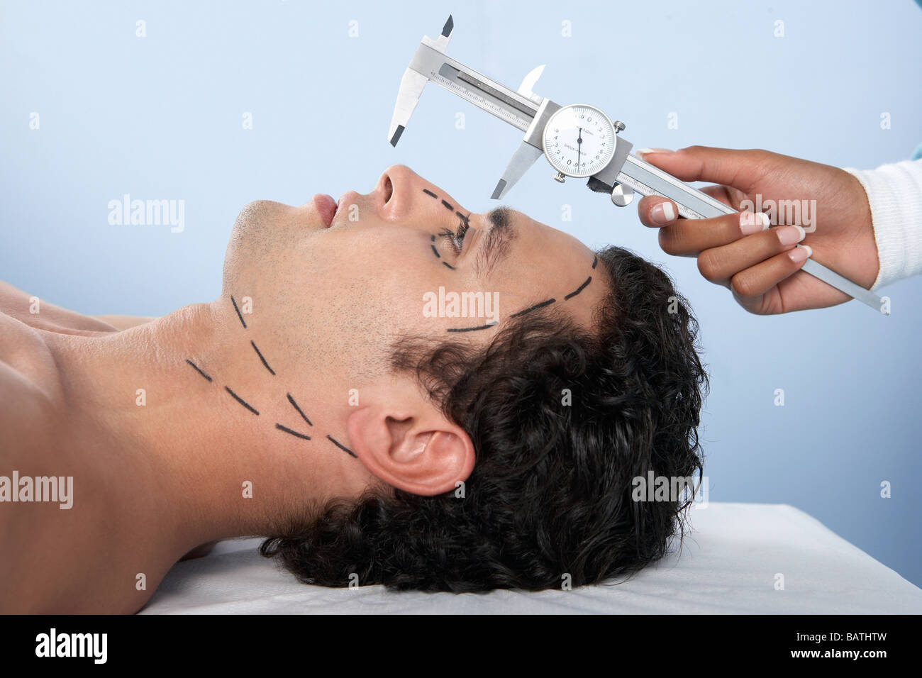Cosmetic surgery. Vernier calipers being used by a surgeon to measure ...