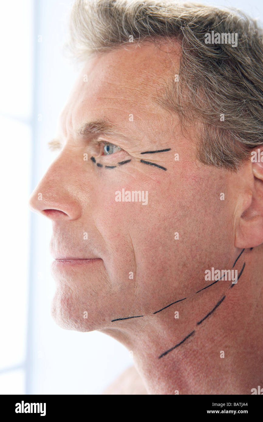 Man face surgery marks hi-res stock photography and images - Alamy