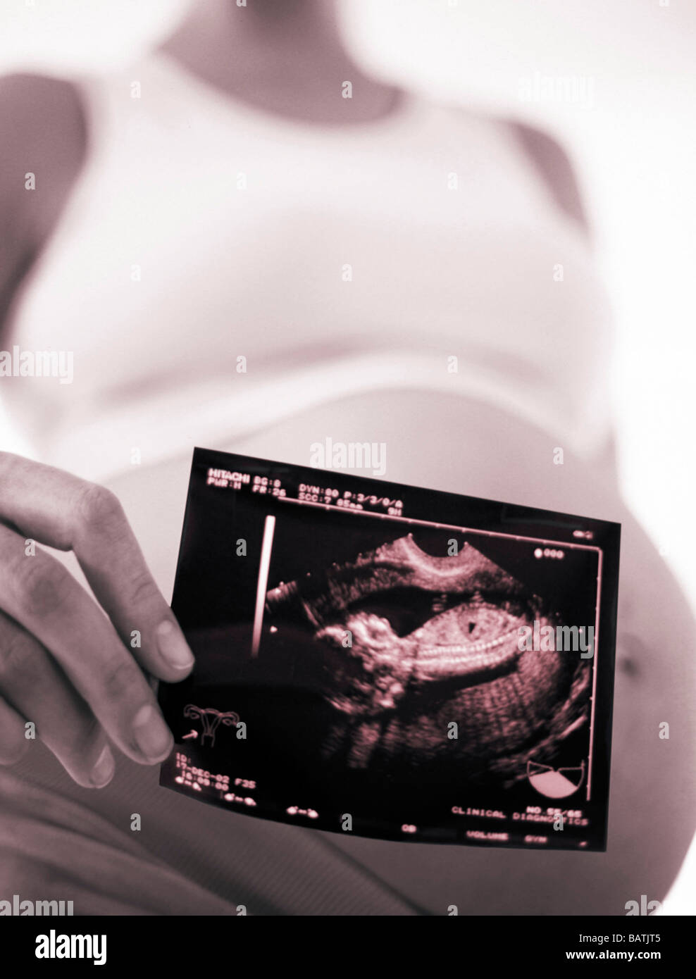Ultrasound scan. Pregnant woman holding anultrasound scan of her foetus ...