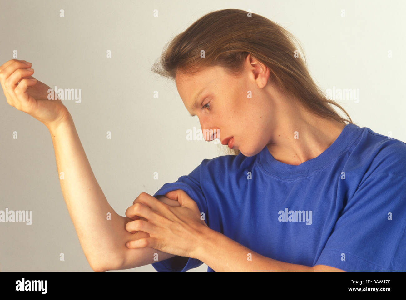 woman scratching her arm Stock Photo - Alamy
