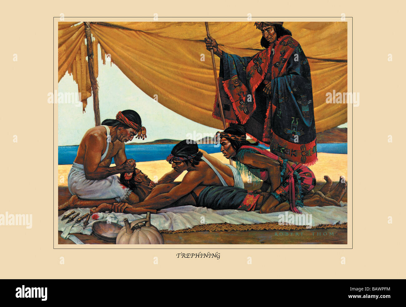 Trephining hi-res stock photography and images - Alamy