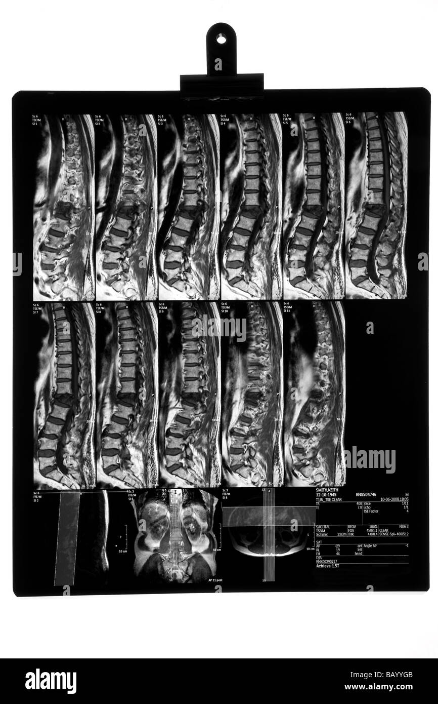 M r i hi-res stock photography and images - Alamy