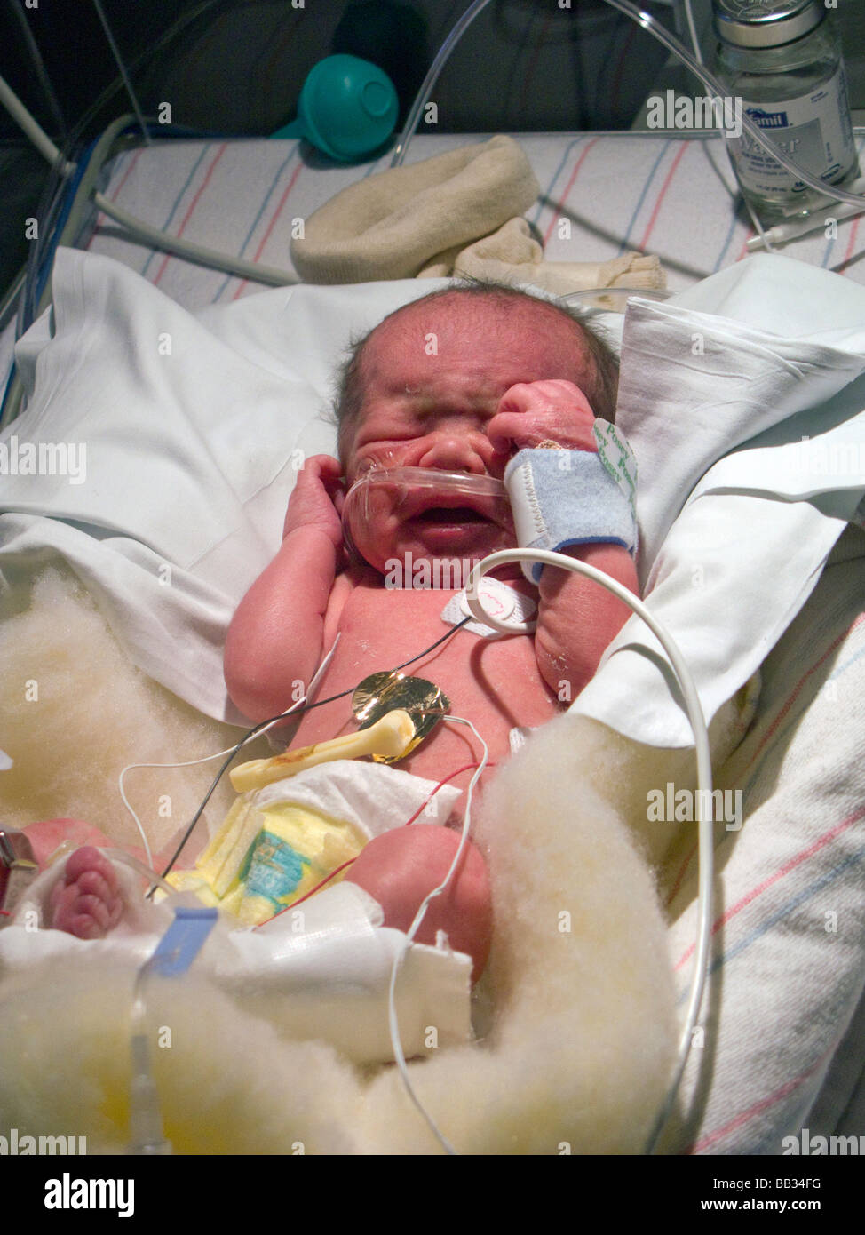 Newborn infant in NICU with oxygen Boston's Children's Hospital (MR ...