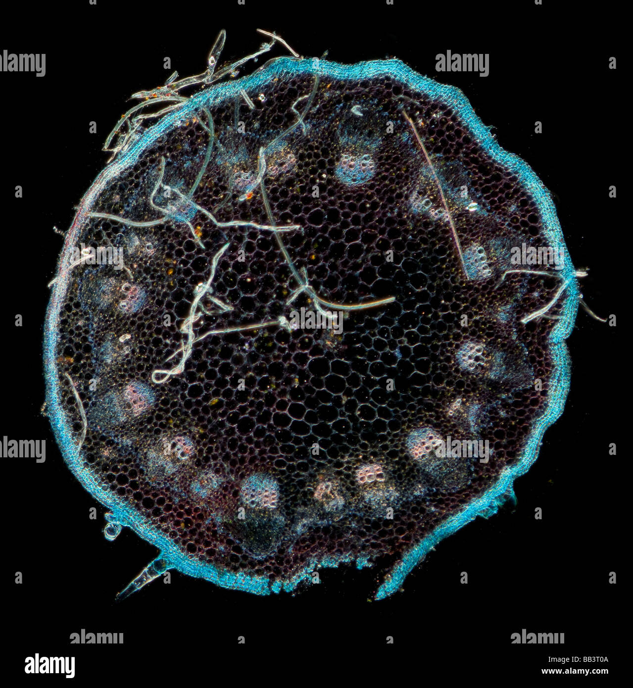 Sunflower stem T.S. stained slide section darkfield photomicrograph ...