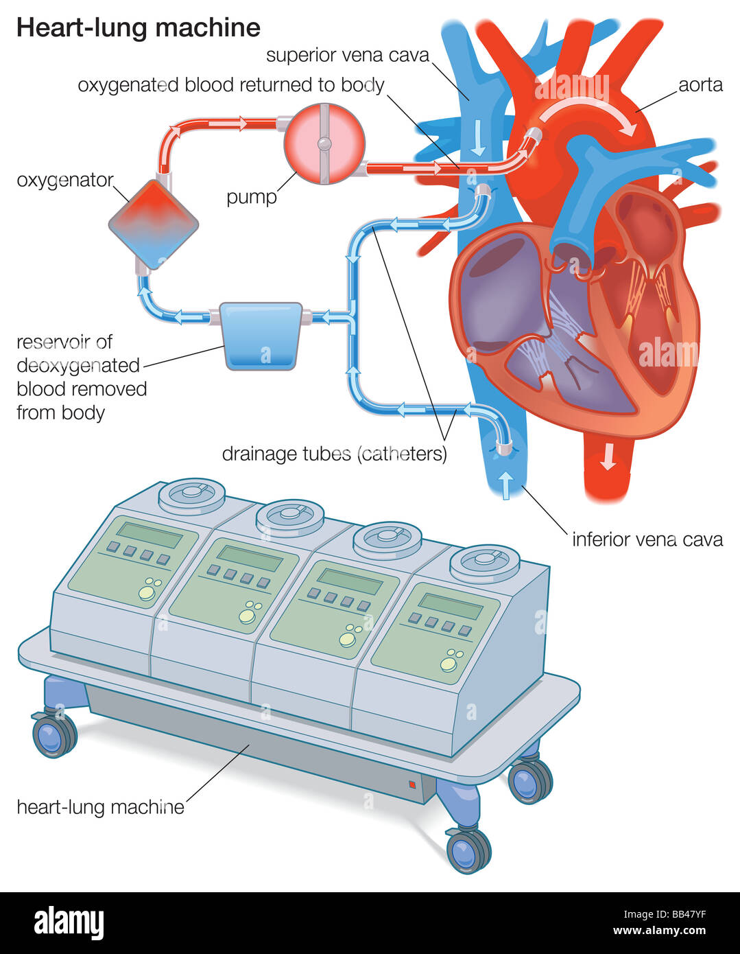 Mechanical heart bypass machine High Resolution Stock Photography and ...