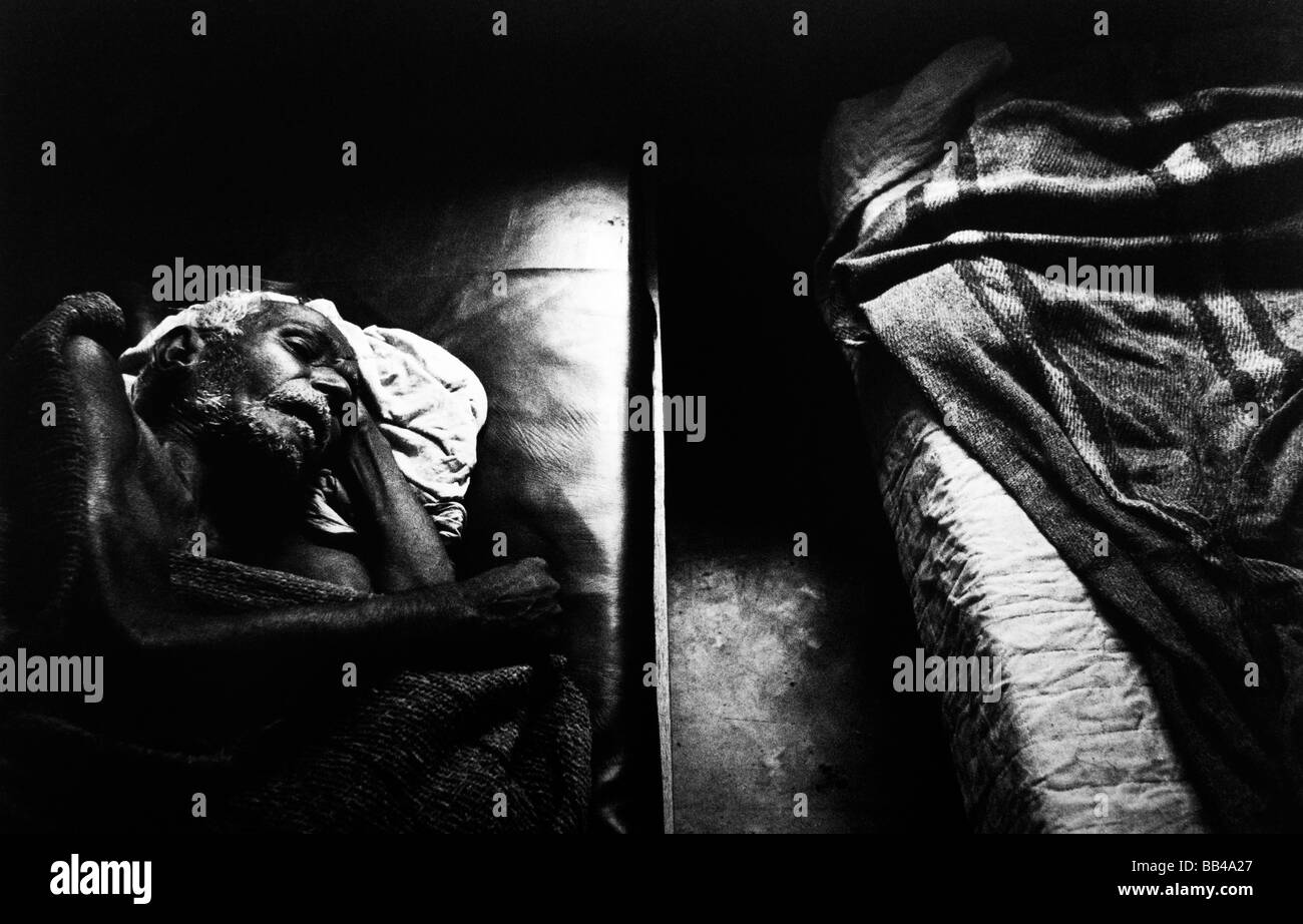 Leprosy patient, resident of the lepers colony in Puri, India Stock ...