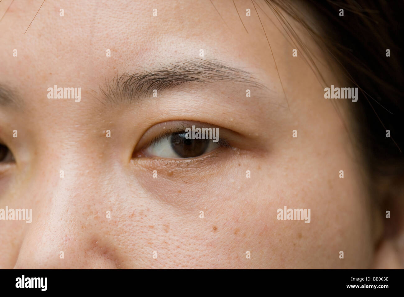 Eyelid operation hi-res stock photography and images - Alamy