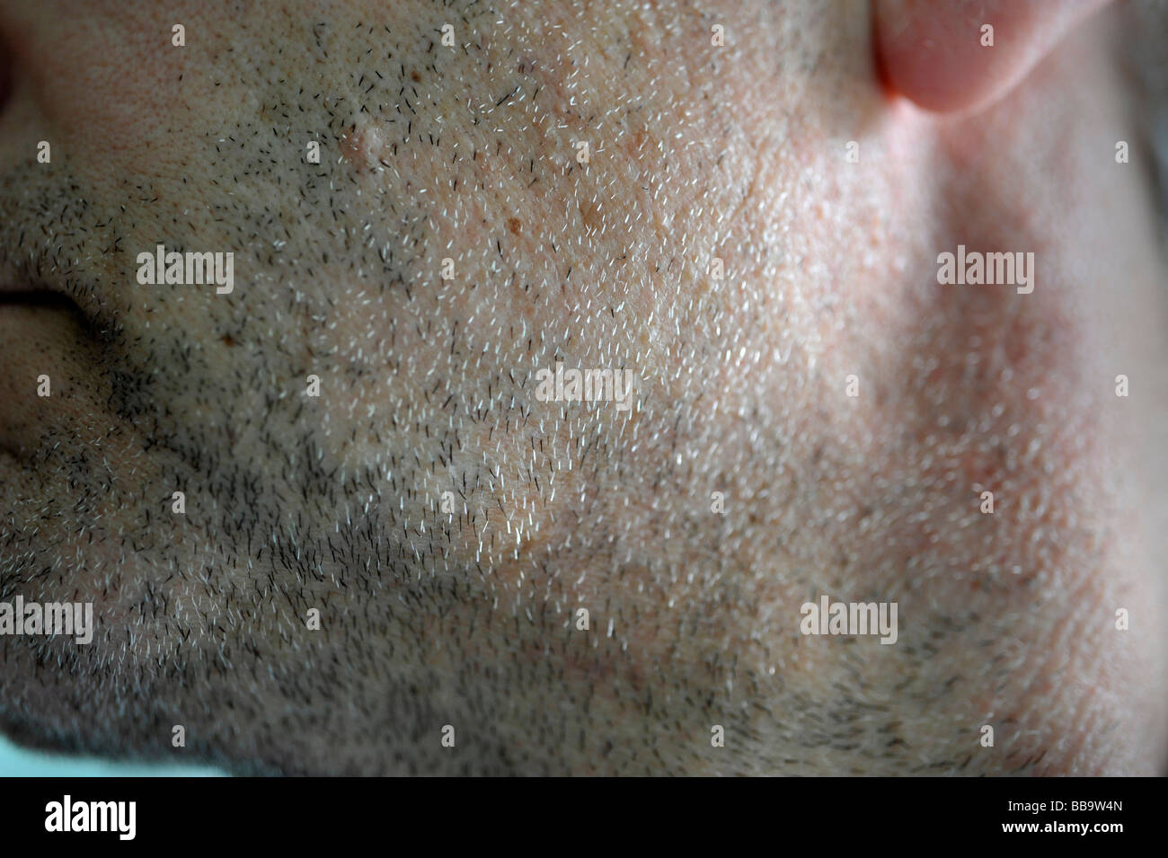 An unshaven man's cheek Stock Photo - Alamy