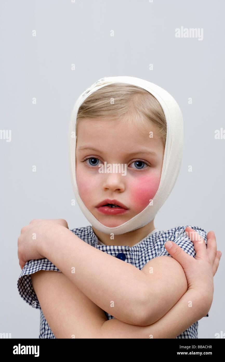 A young girl with a head injury and cheek injury Stock Photo - Alamy