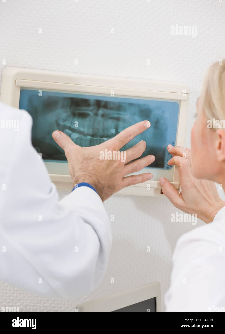 Hand x ray color hi-res stock photography and images - Alamy