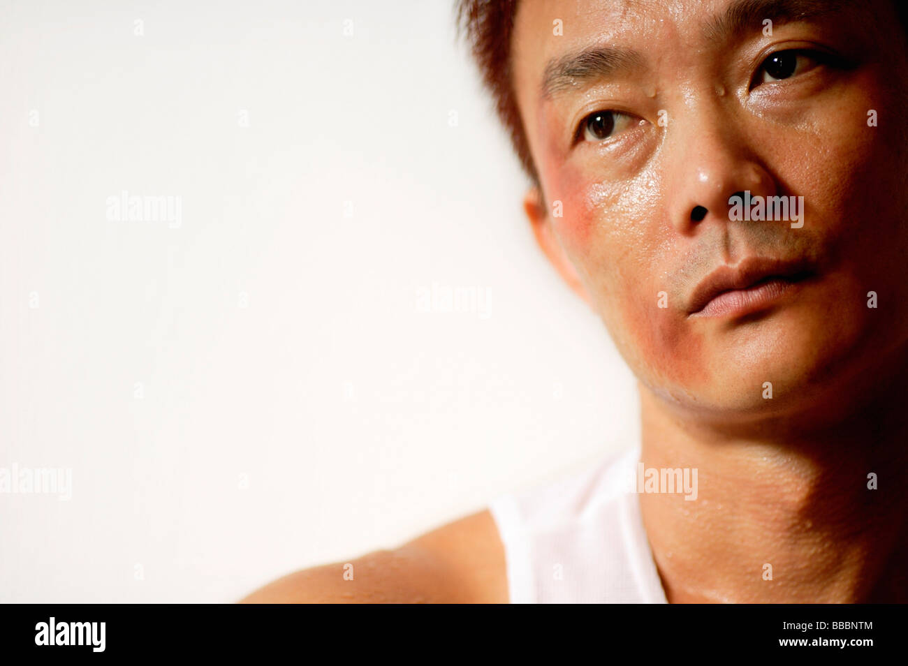 Man with bruised face, looking away Stock Photo - Alamy
