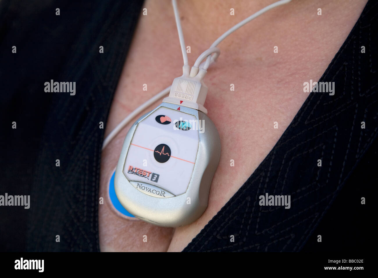 Woman wearing a heart monitor Stock Photo - Alamy