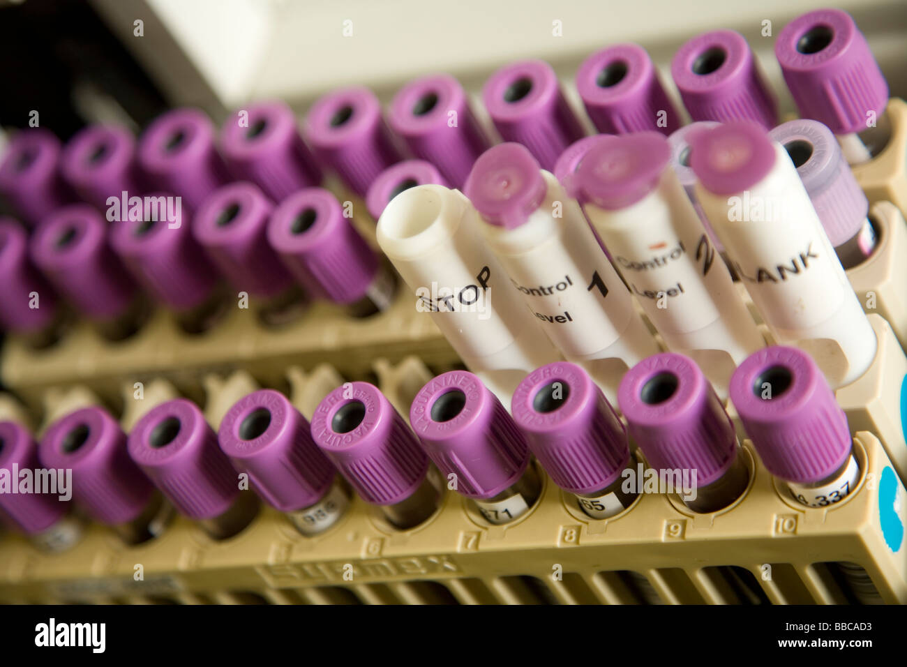 test tube, medical containers, urine samples, test tube Stock Photo - Alamy