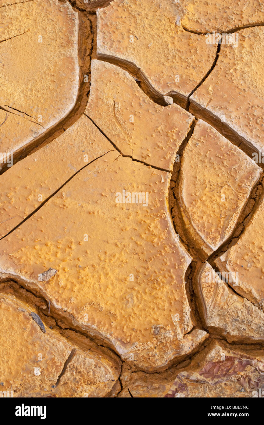 Bone erosion hi-res stock photography and images - Alamy