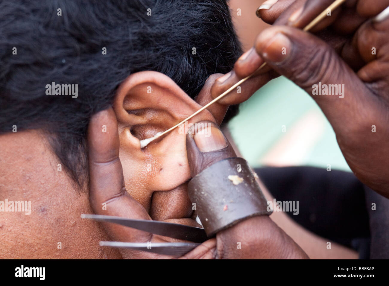 Ear wax hi-res stock photography and images - Alamy