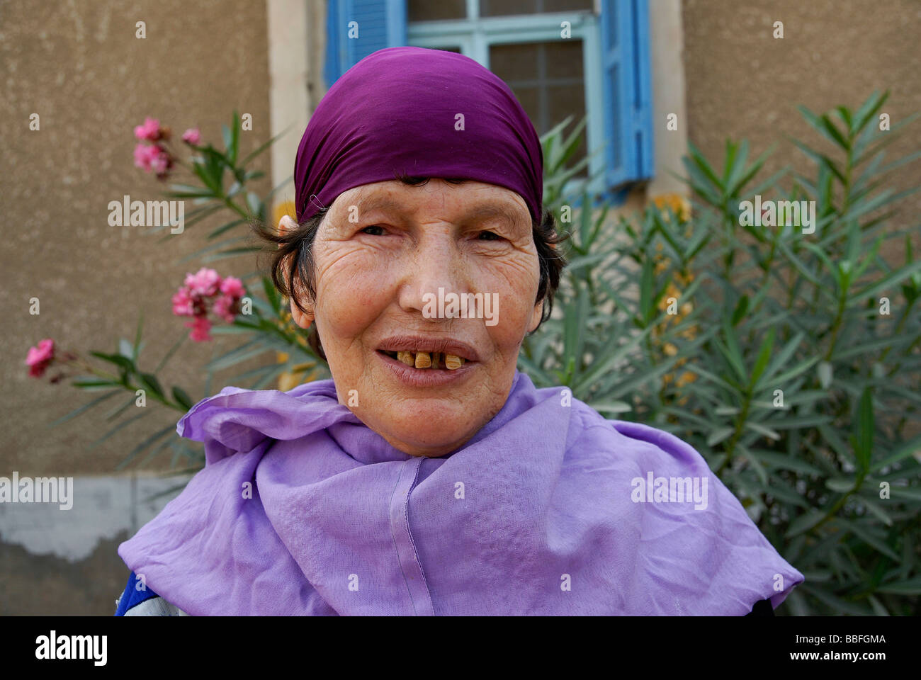 Portrait of a woman who suffers for many years from leprosy and has ...