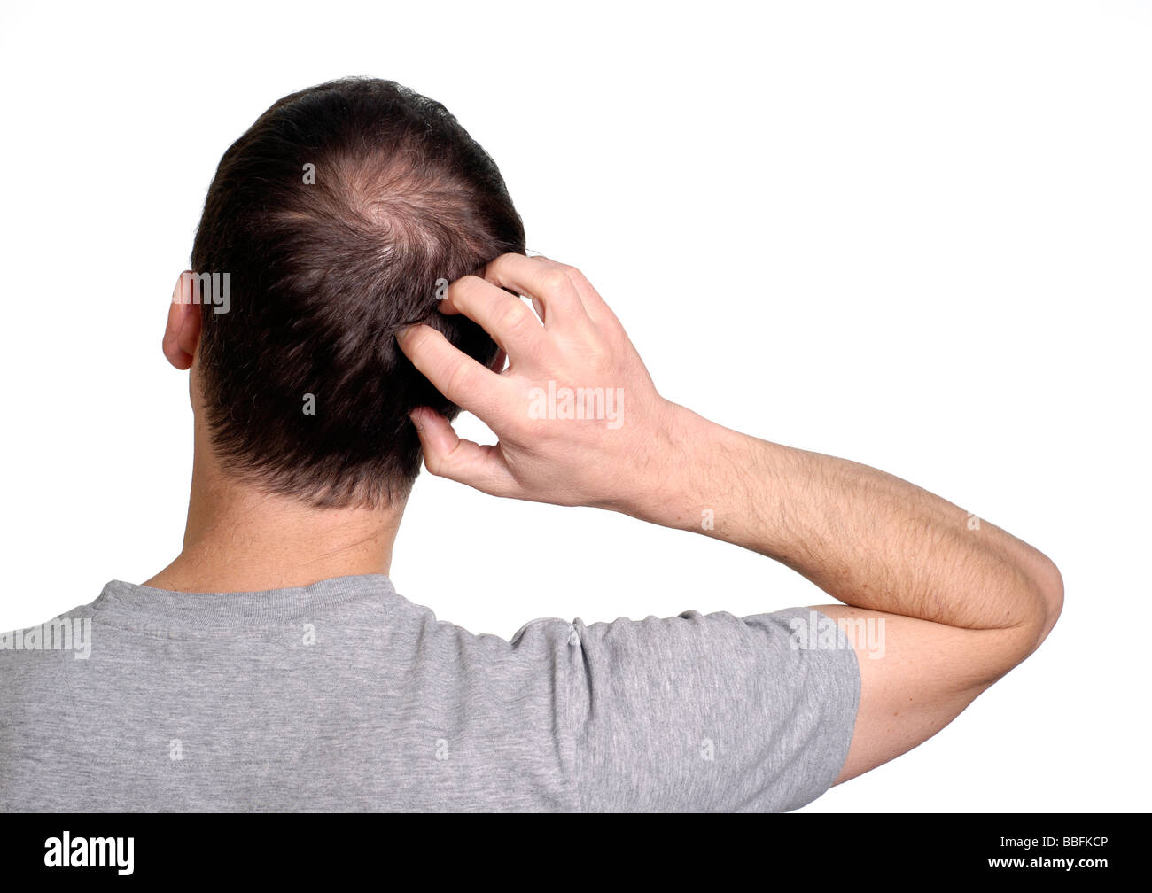 Man scratching the back of his head Stock Photo - Alamy