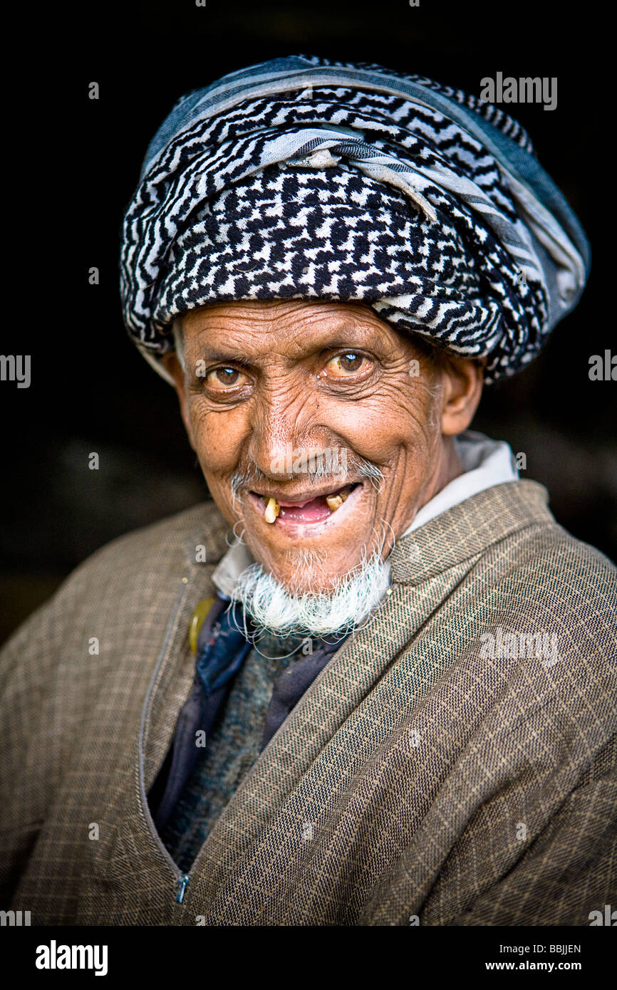 Ugly Man With No Teeth