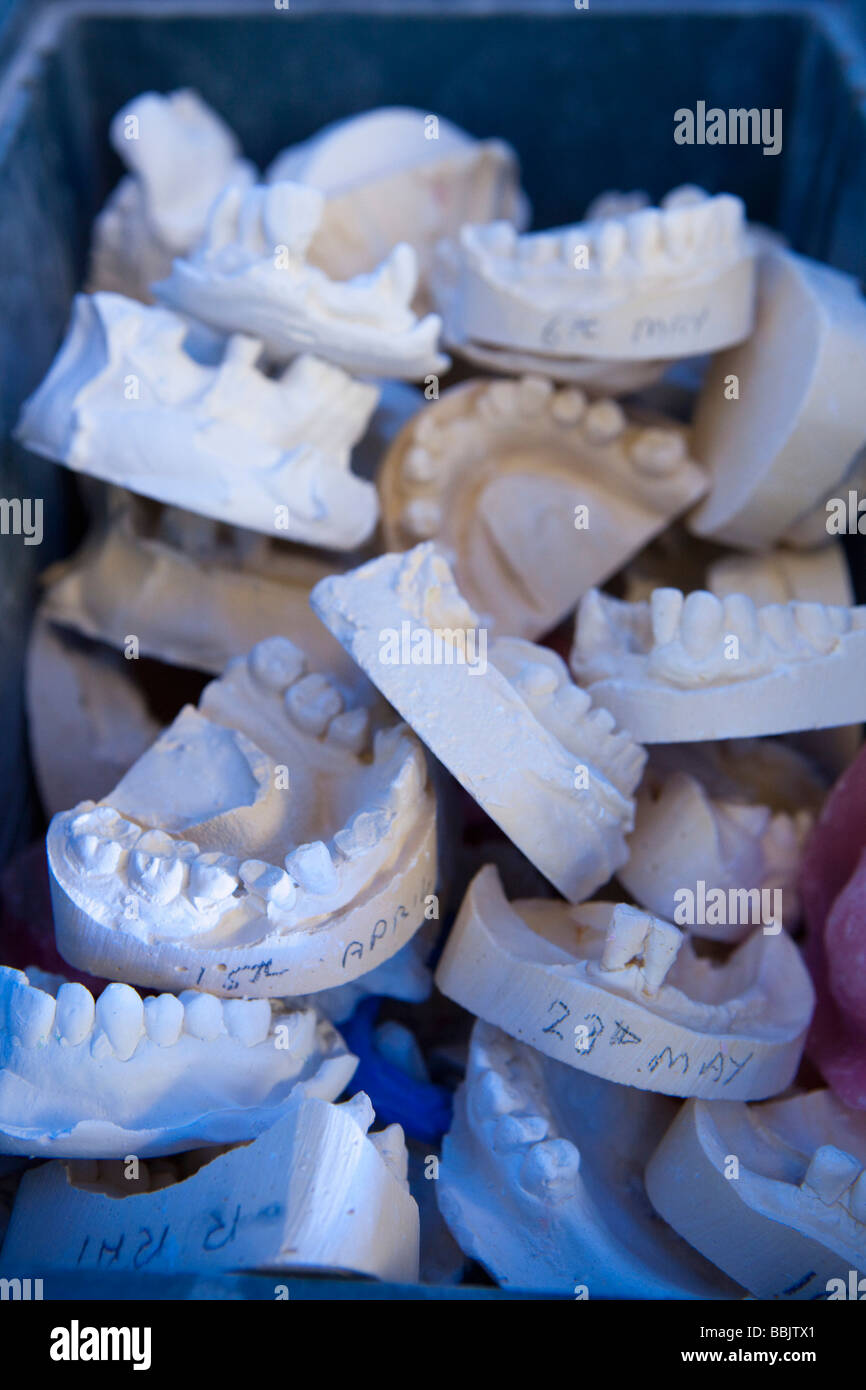 Plaster Teeth Molds in blue box Stock Photo - Alamy