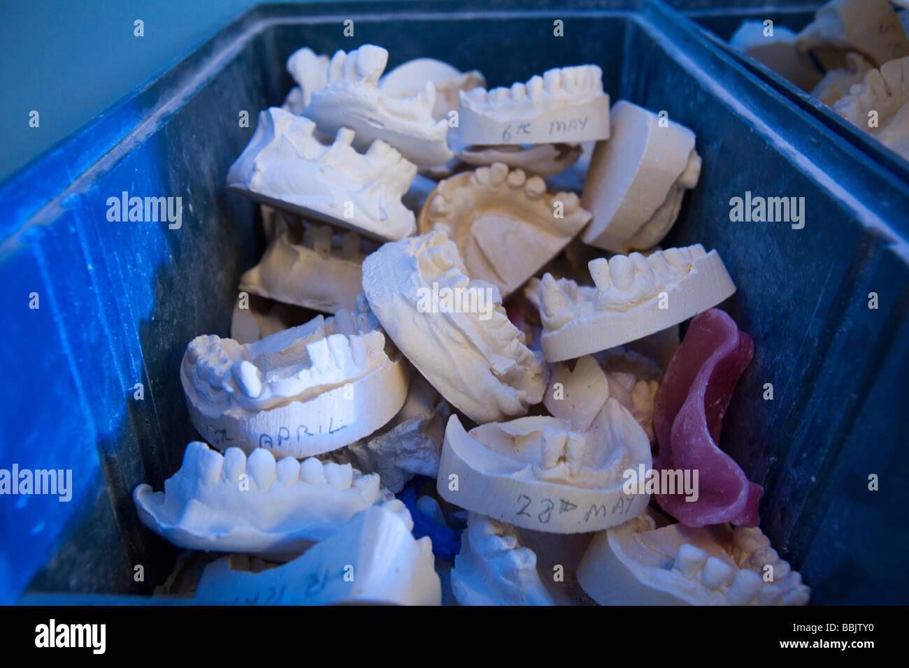 Plaster Teeth Molds in blue box Stock Photo - Alamy