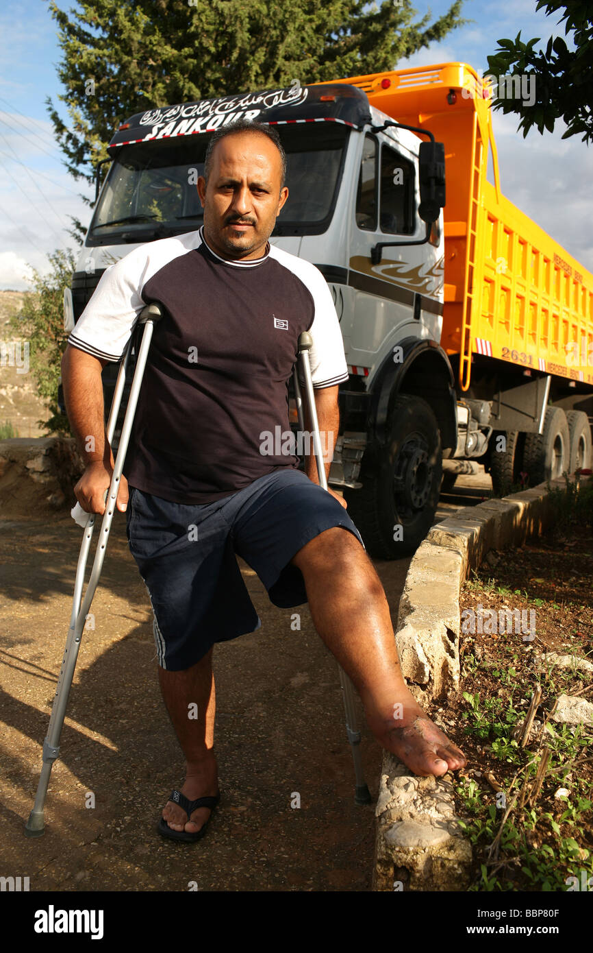 CLUSTER BOMB VICTIMS, FOLLOWING THE JULY 2006 WAR IN SOUTH LEBANON ...
