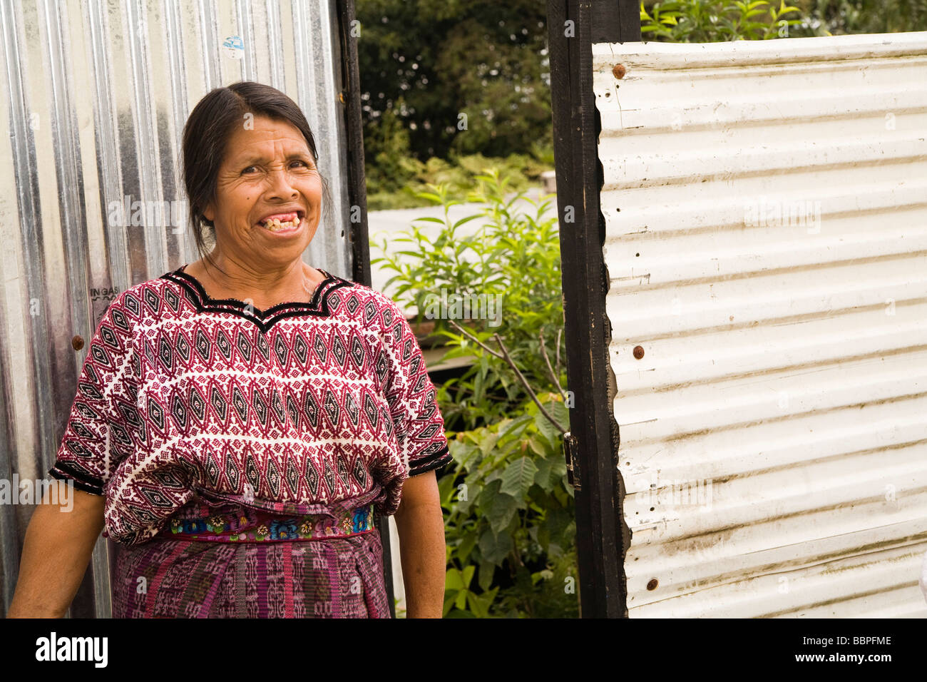 Tooth pics hi-res stock photography and images - Alamy