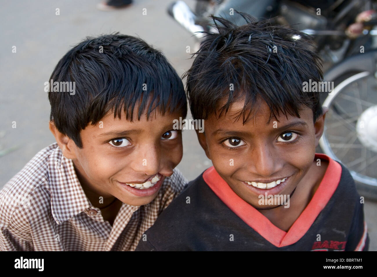 Cleft lip india hi-res stock photography and images - Alamy