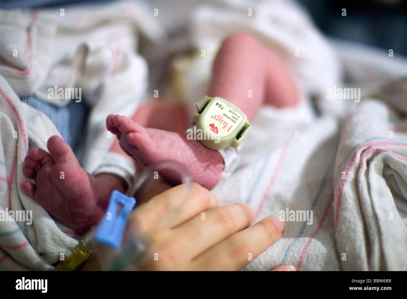 Newborn boy's leg fitted with "baby lojak", a sensor which will sound ...