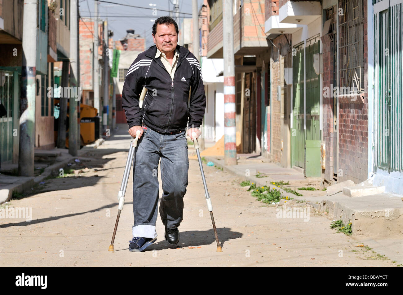 Leprosy patient with crutches on the street, Bogota, Colombia, South ...