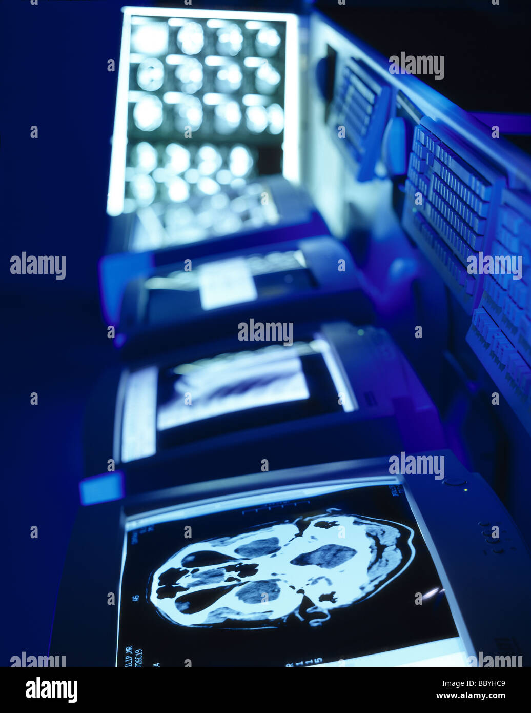 Nhs Mri Stock Photos & Nhs Mri Stock Images - Alamy