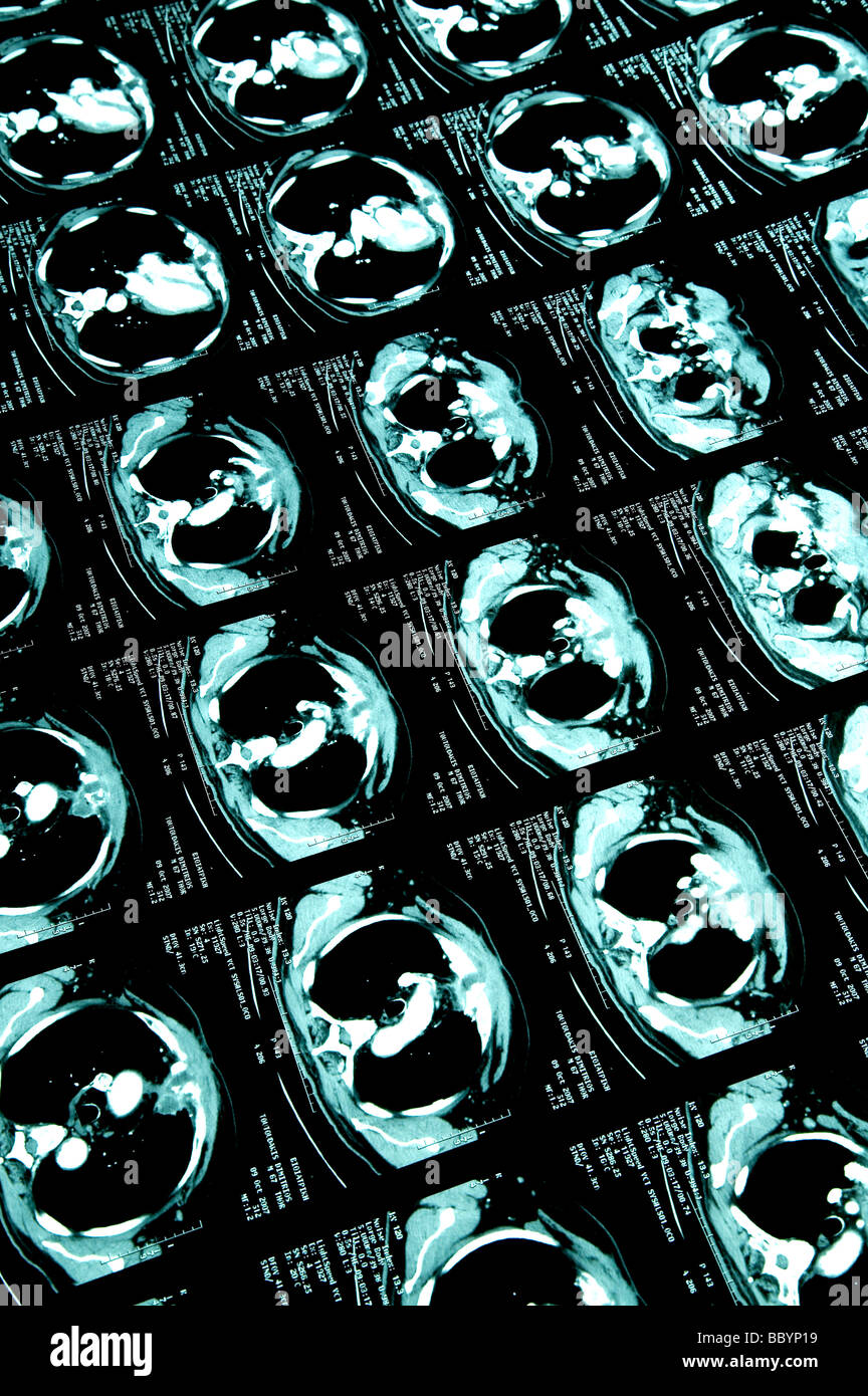 Diagnostic scans hi-res stock photography and images - Alamy
