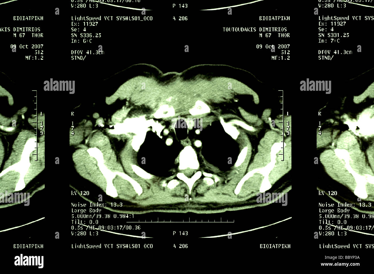 Scan images hi-res stock photography and images - Alamy