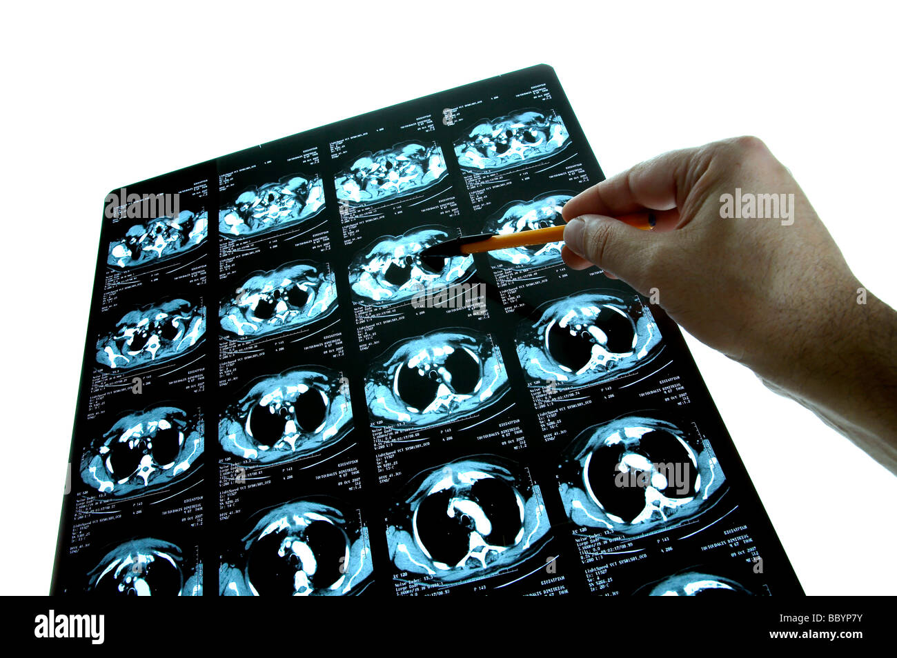 Med01175 hi-res stock photography and images - Alamy