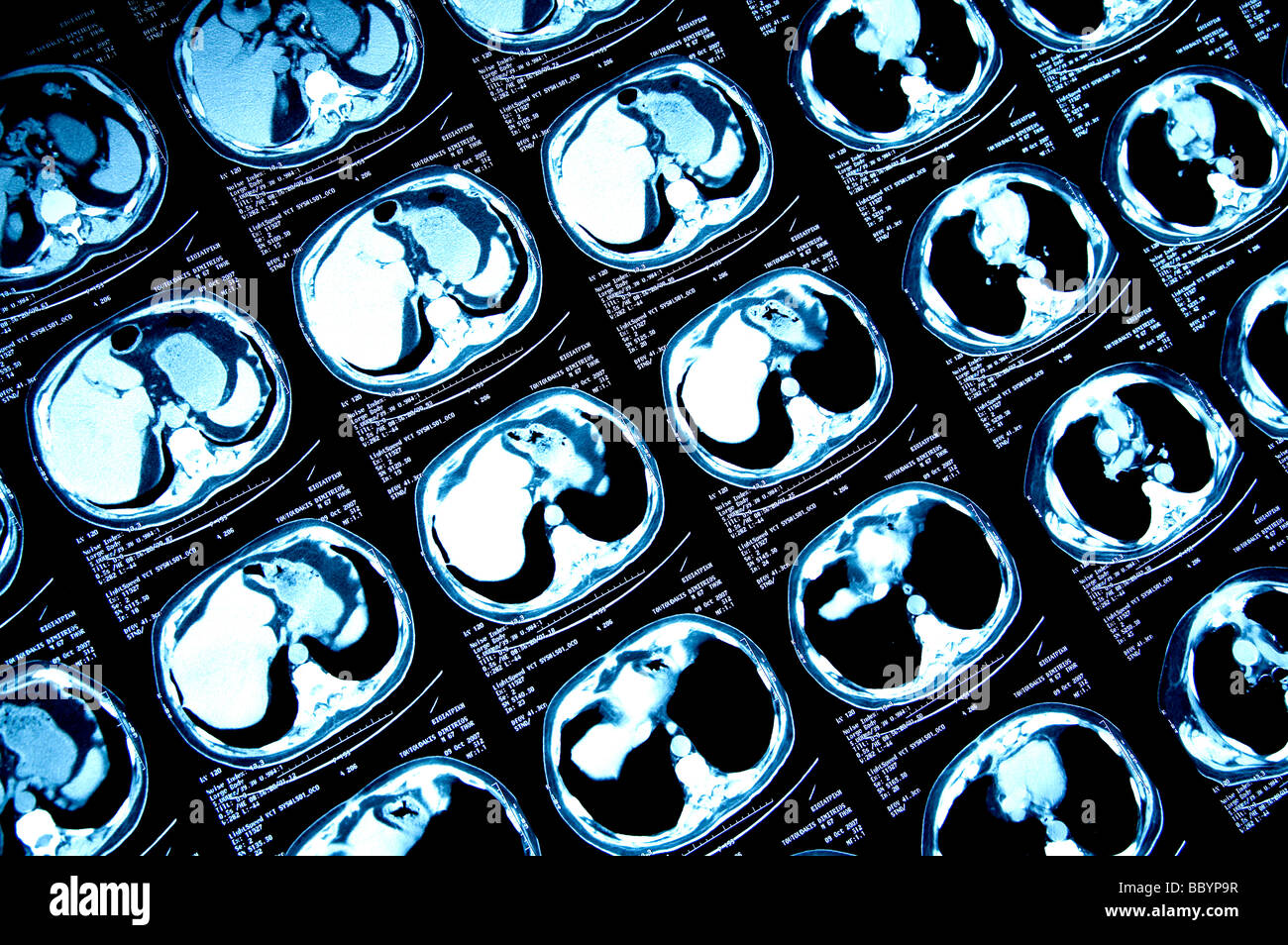 Diagnostic scans hi-res stock photography and images - Alamy