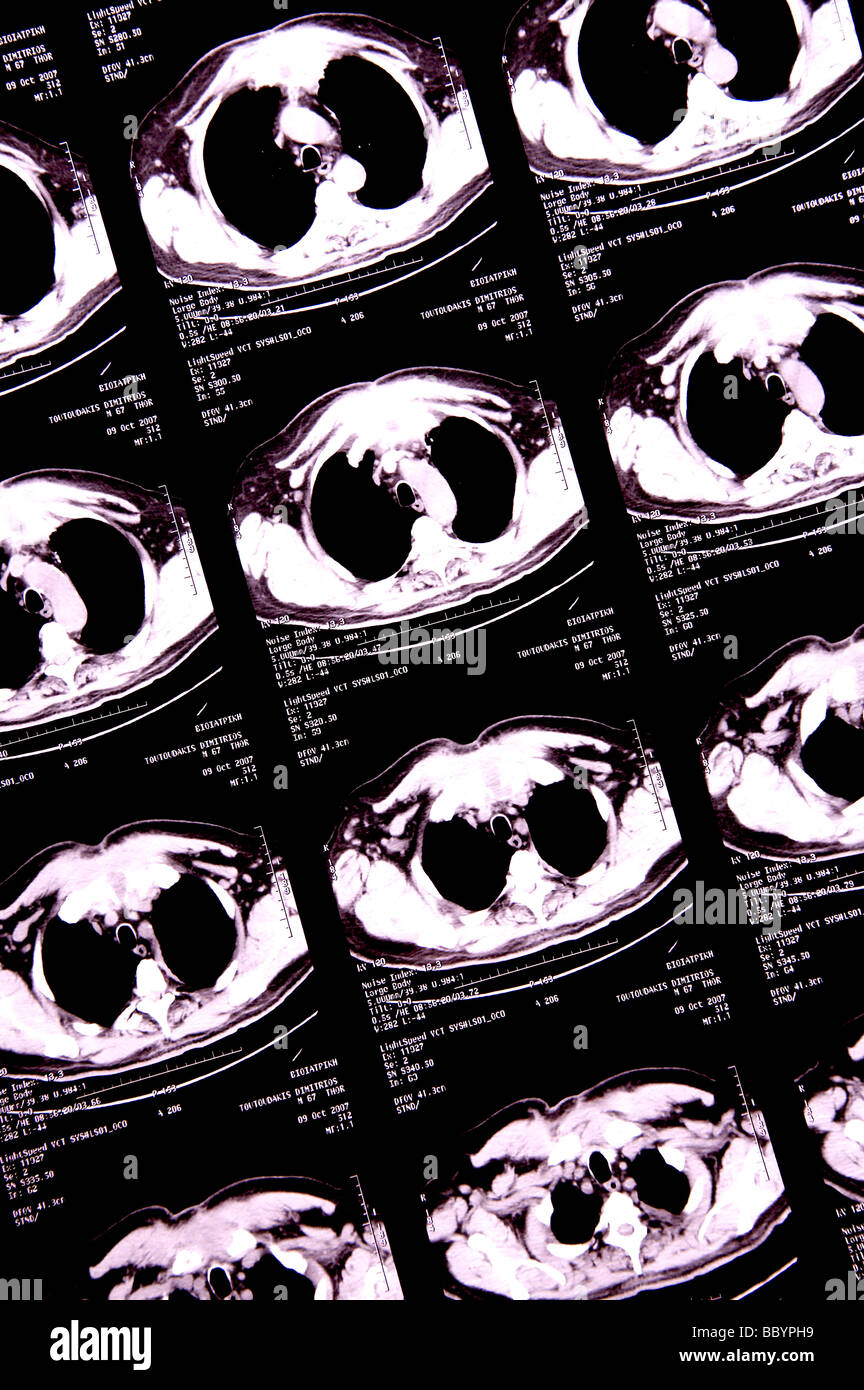 Med01182 hi-res stock photography and images - Alamy