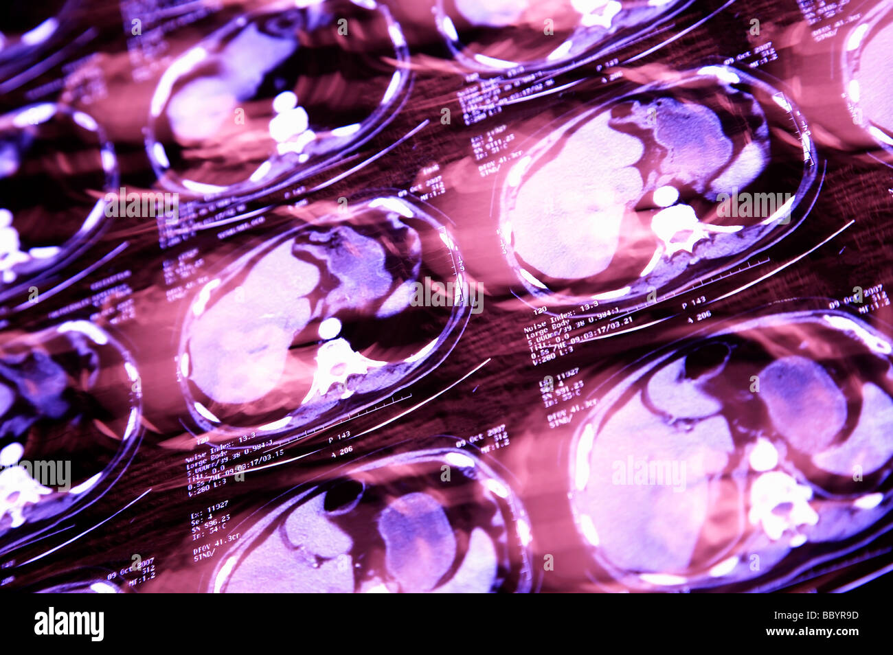 Preventive medical examination hi-res stock photography and images - Alamy