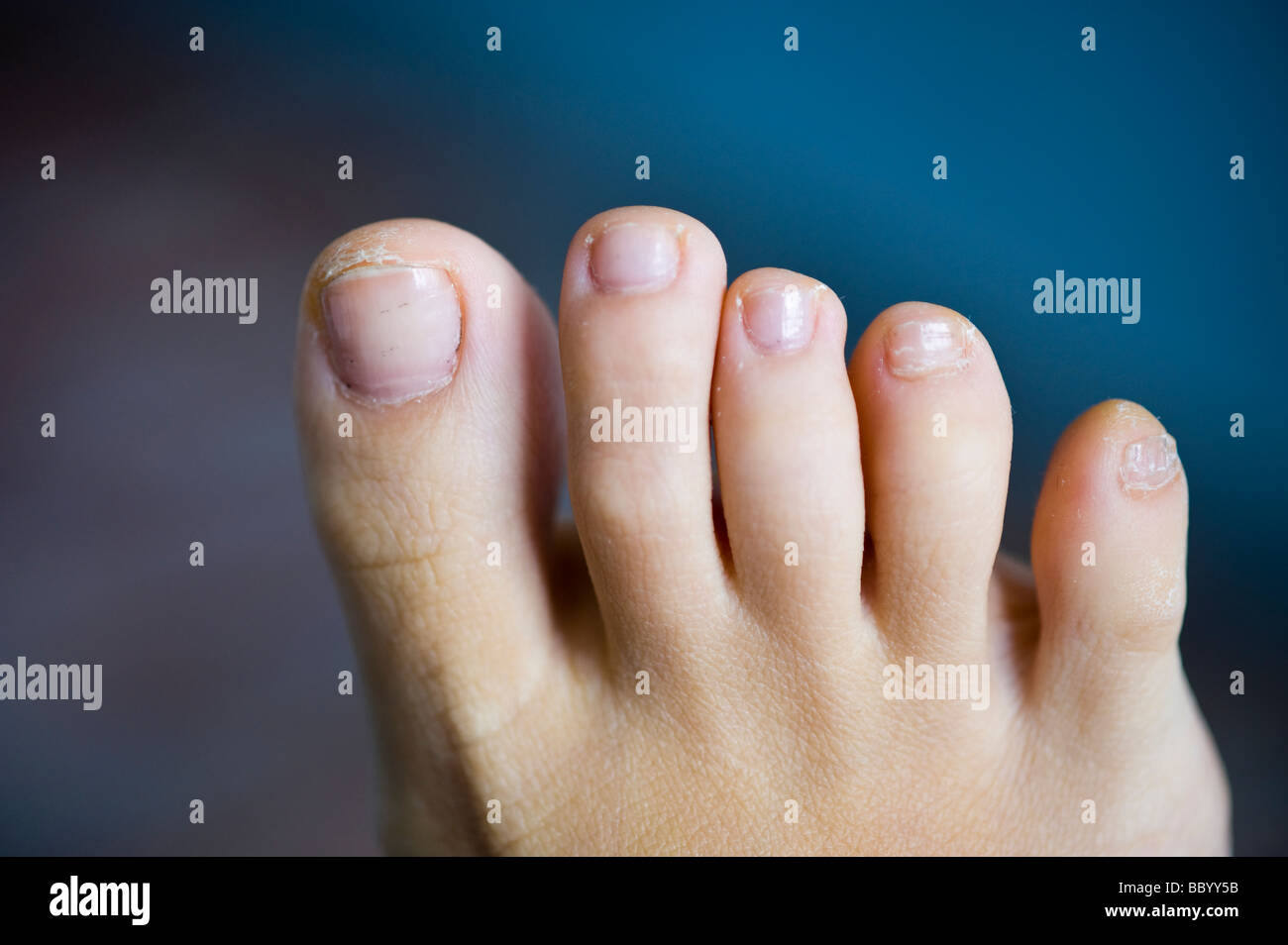 Human toenail hi-res stock photography and images - Alamy