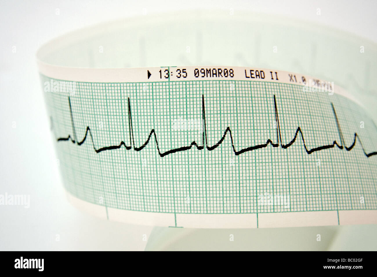 Heart rhythm hi-res stock photography and images - Alamy