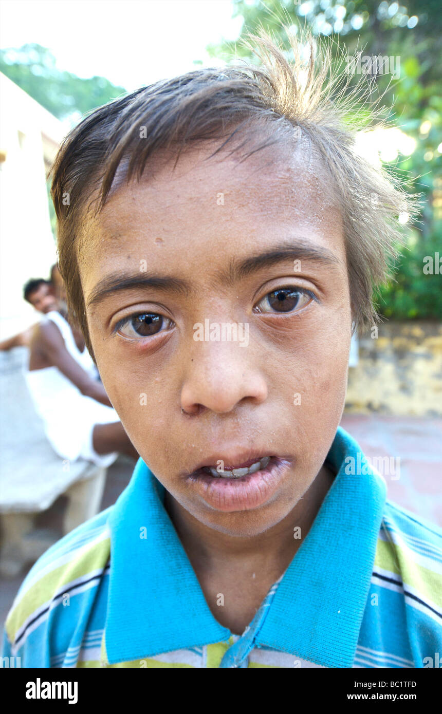 Disabled people india hi-res stock photography and images - Alamy