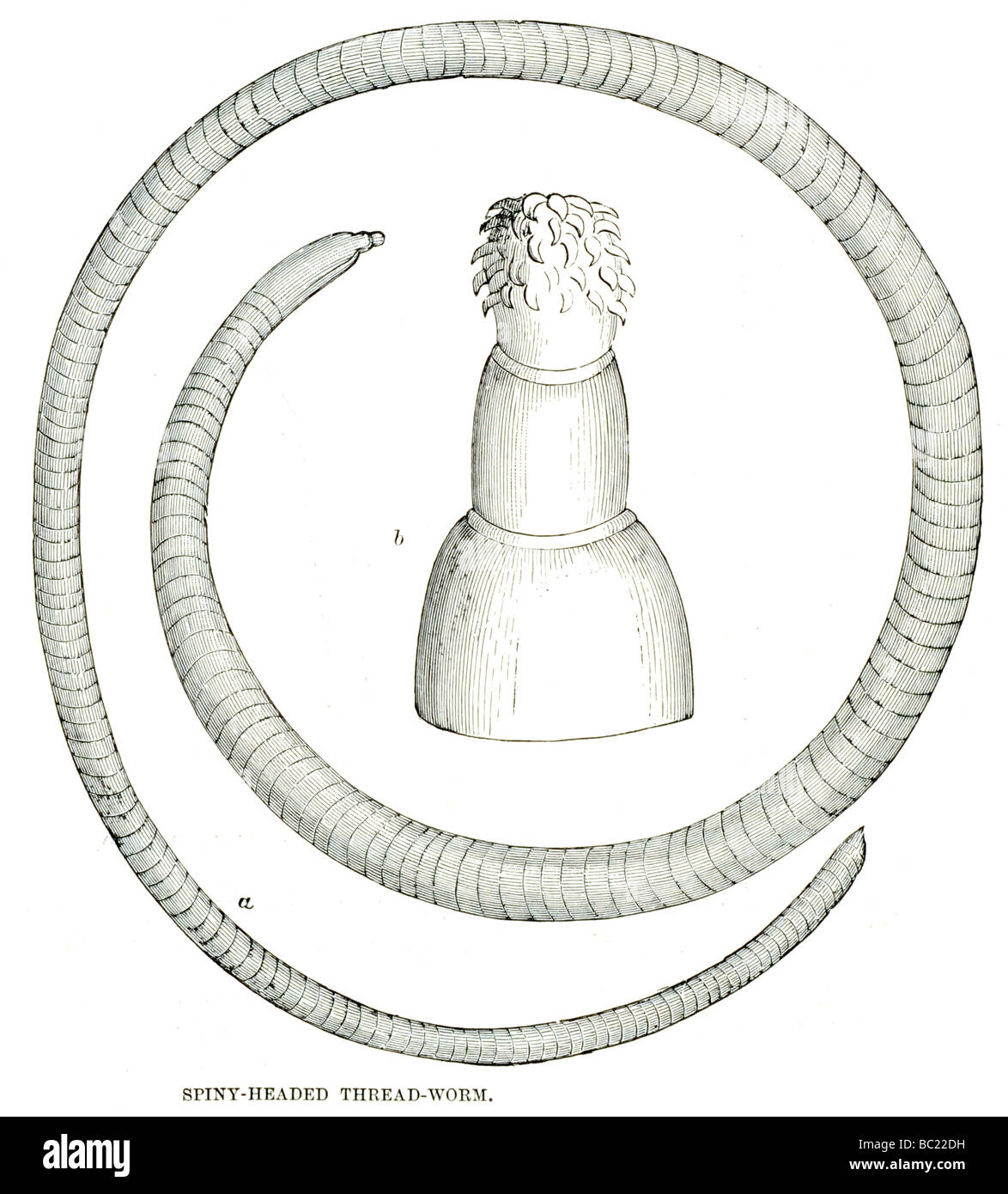 spiny headed thread worm Stock Photo - Alamy