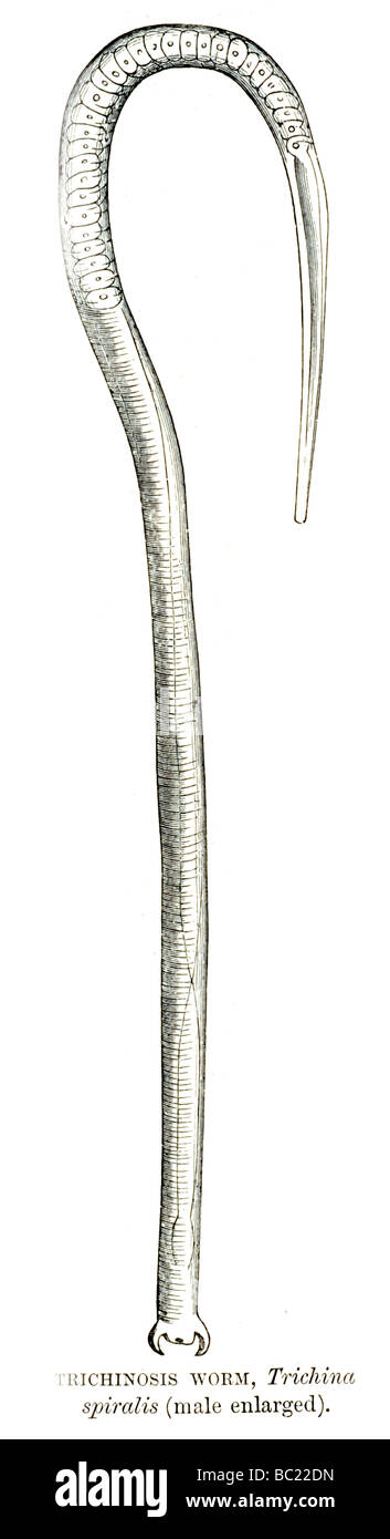 Trichinosis hi-res stock photography and images - Alamy